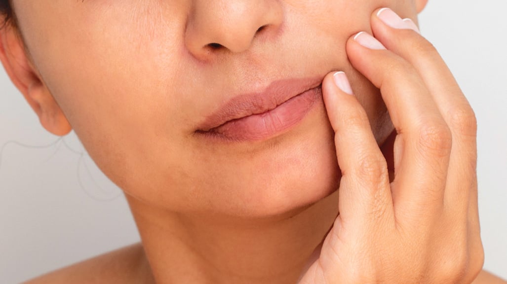 dry circle on forehead