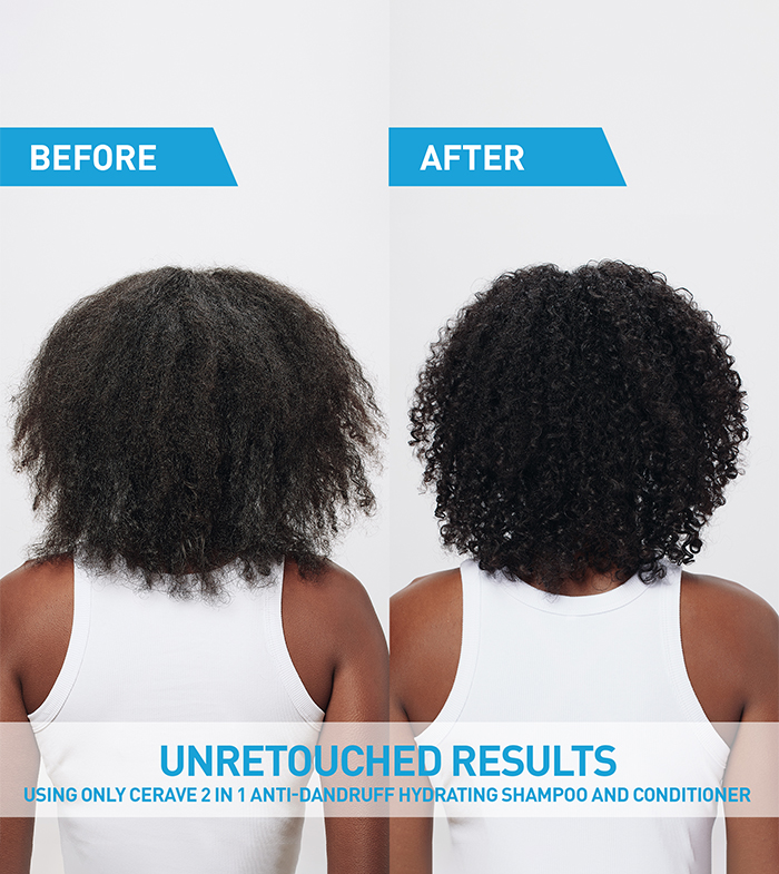 2-in-1 Anti-Dandruff Hydrating Shampoo & Conditioner | CeraVe