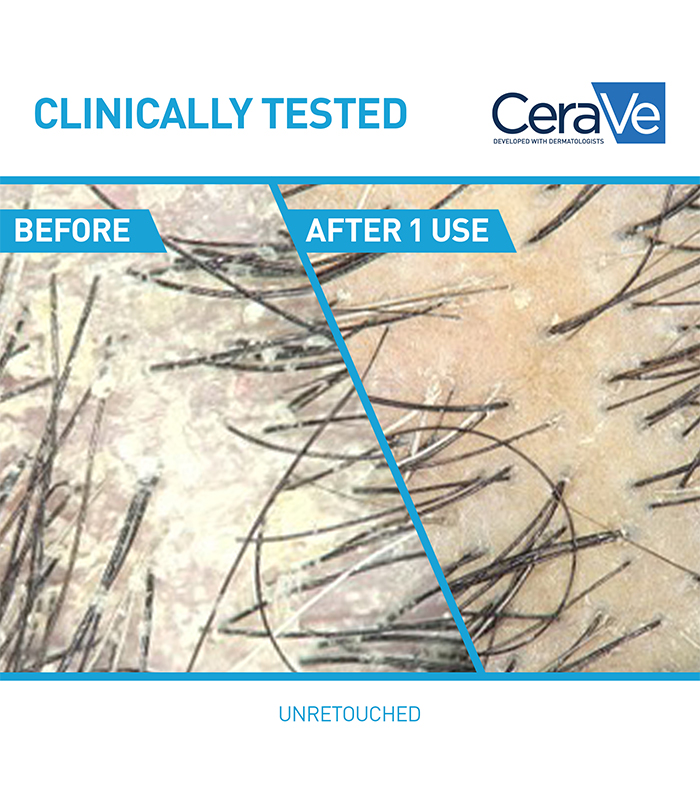 Anti Dandruff Hydrating Conditioner For All Hair Types Cerave