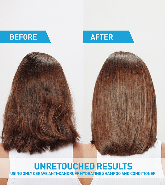 Anti-Dandruff Hydrating Conditioner for All Hair Types | CeraVe