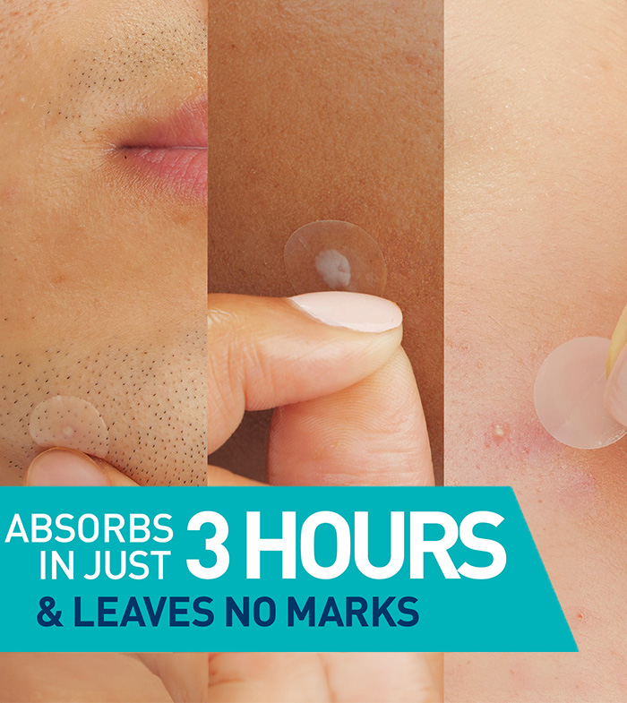 Blemish Barrier Patches | CeraVe