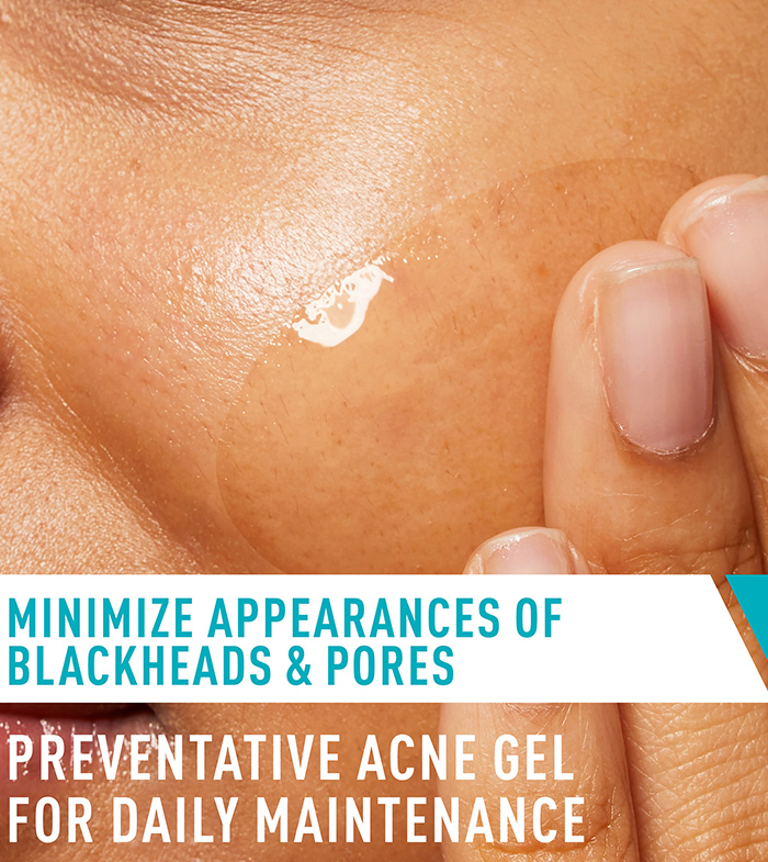 Acne Control Gel: Targeted Treatment | CeraVe