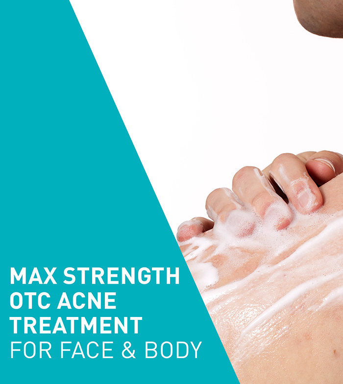 Acne Foaming Cream Wash with Benzoyl Peroxide | CeraVe